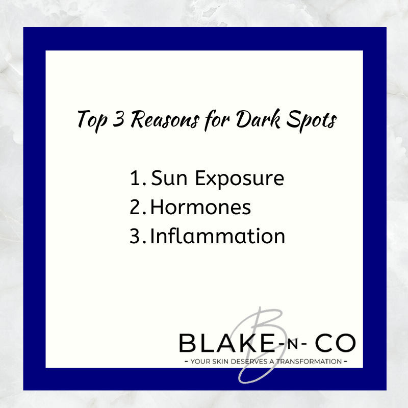 What Causes Dark Spots? – Blake N Co